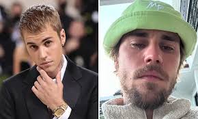 Justin Bieber's Emotional Social Media Posts Raise Concerns Among Fans ...